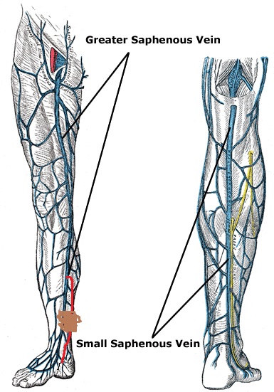 saphène interne - formation lasers médicaux